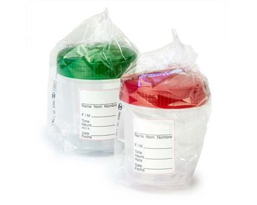 Urine Collection Specimen Containers | Globe- MG Scientific