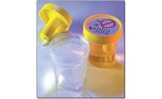 Urine Collection Specimen Containers | Globe- MG Scientific