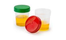 Urine Collection Specimen Containers | Globe- MG Scientific